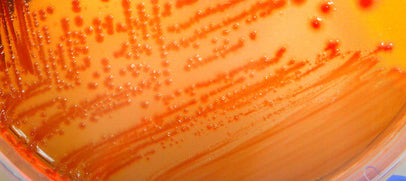 Cell Based Assay Kit – GenDEPOT