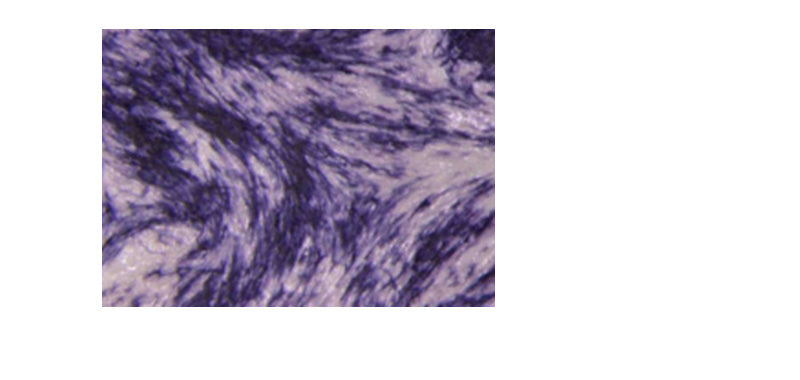 BCIP/NBT Solution for IHC – GenDEPOT